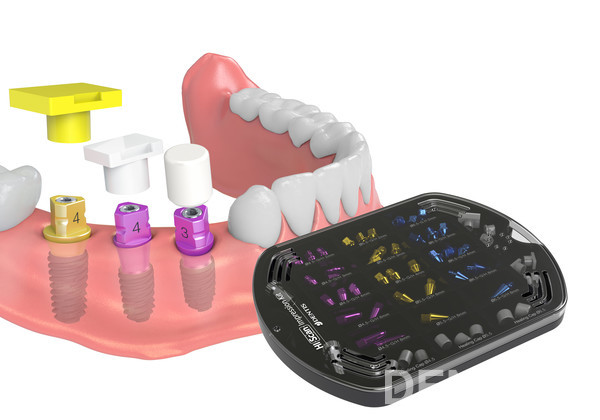 덴티스 ‘Multi Use Coping’ 보철 솔루션으로 인기