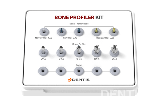 임플란트의 시작과 끝, 덴티스 ‘BONE PROFILER KIT’로